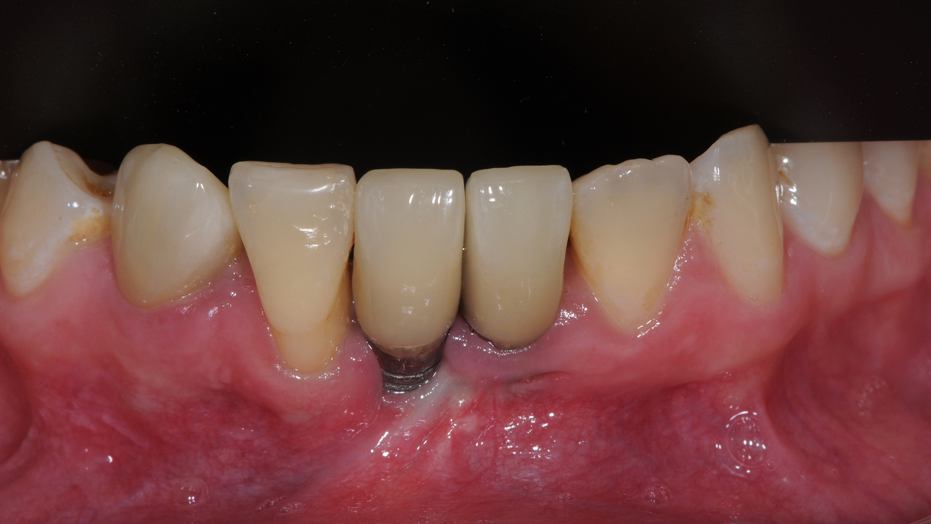/ Klinische Knacknüsse – Behandlung von Komplikationen - Zentrum für ...